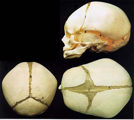 Fetal Skull Fontanels Anterolateral