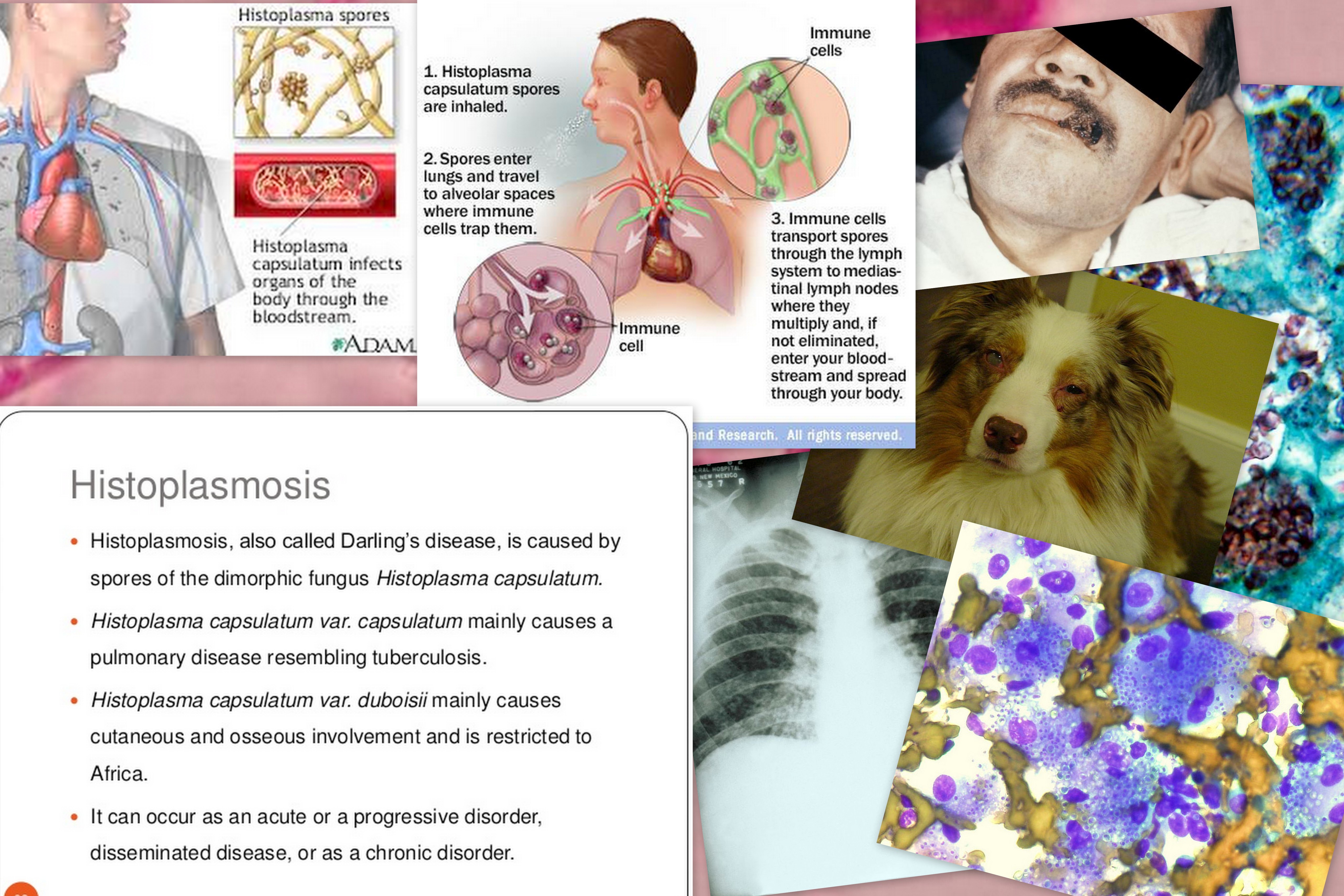 Histoplasmosis Urine Antigen Test Dog at Valerie Lemmons blog